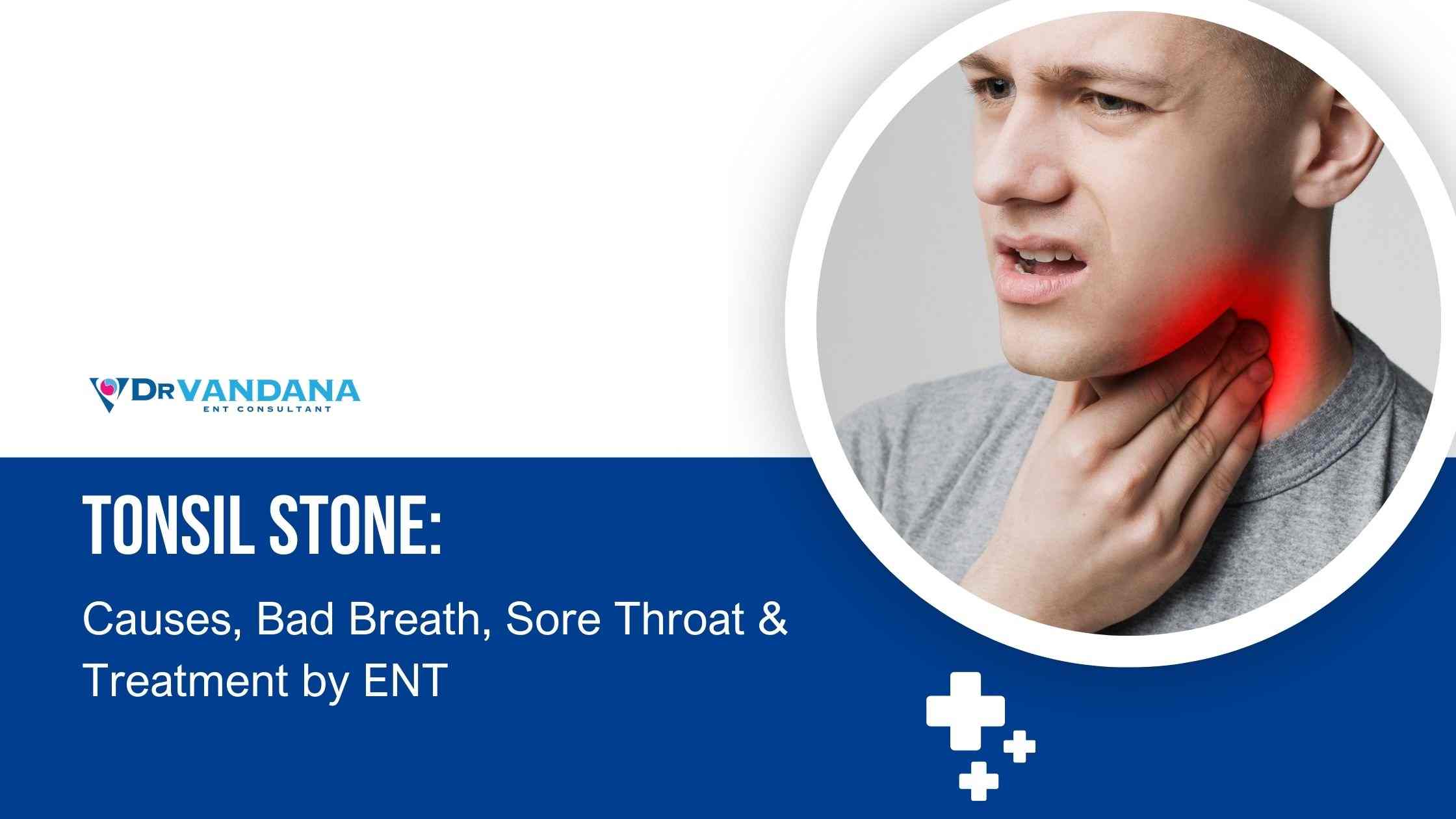 Tonsil Stones: Why They Form & How to Prevent Them | Dr. Vandana Binu