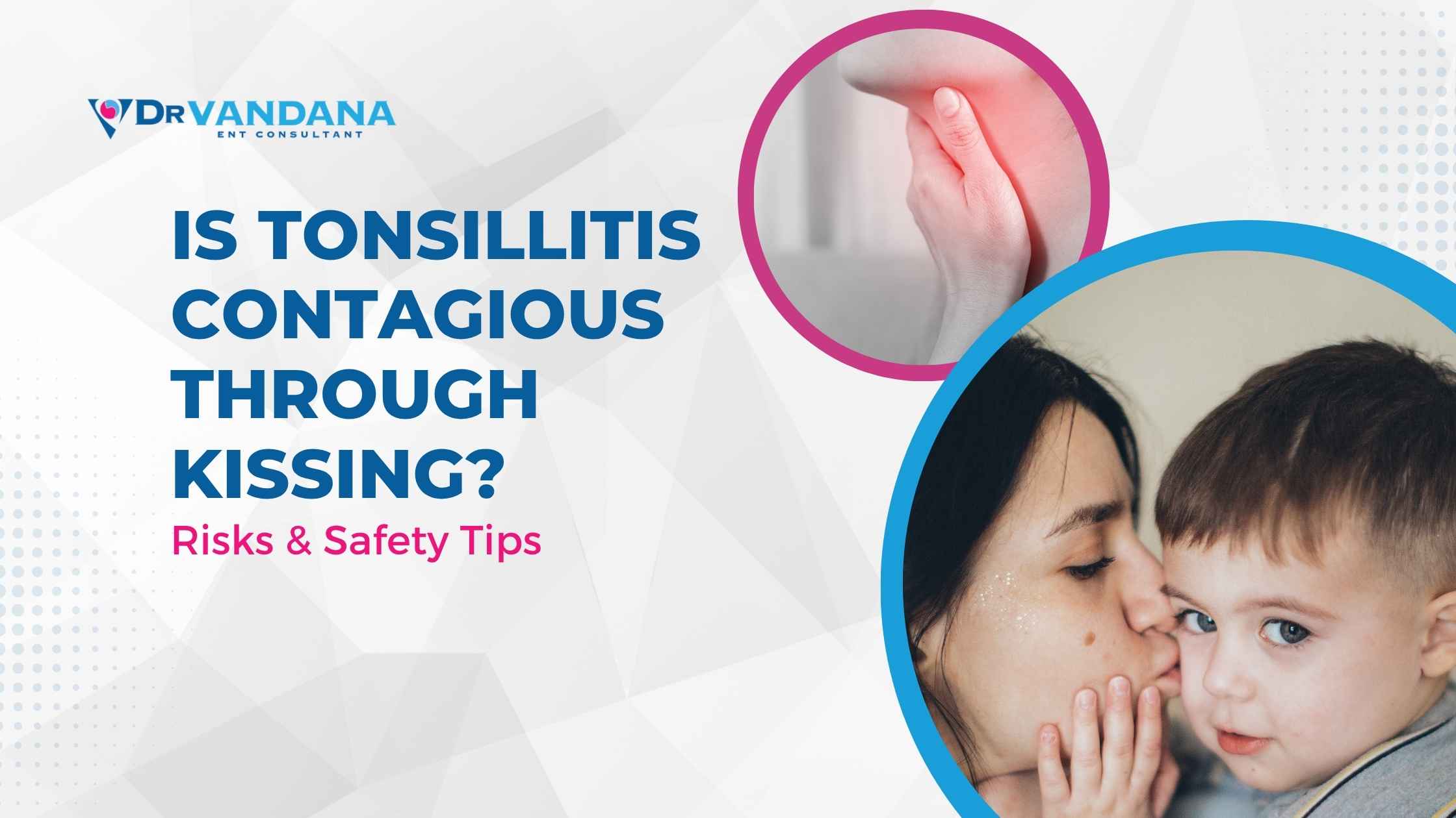 Can You Get Tonsillitis from Kissing? Expert Safety Guide